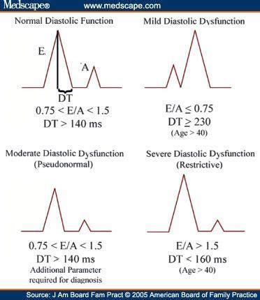10 Best Echo Images Cardiac Nursing Medical Education Cardiology