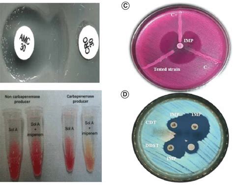 Phenotypic Detection Of Emerging B Lactamase Producing Bacteria And