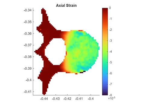 Medical Image Based Finite Element Analysis Of Spine Matlab And Simulink