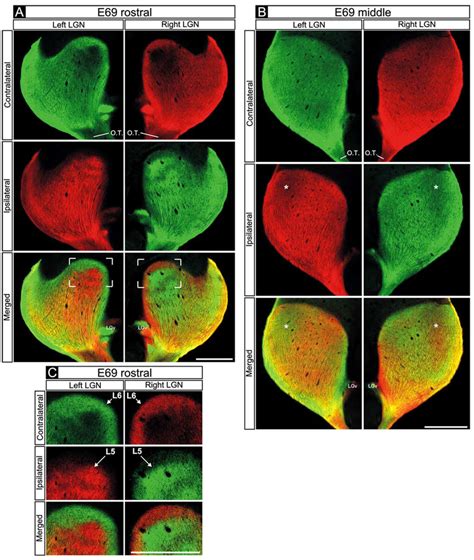 Retinogeniculate Projections To The Dlgn On E69ac Contralateral