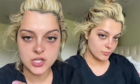 Bebe Rexha Opens Up About Her Difficult Battle With Pcos Newsfinale