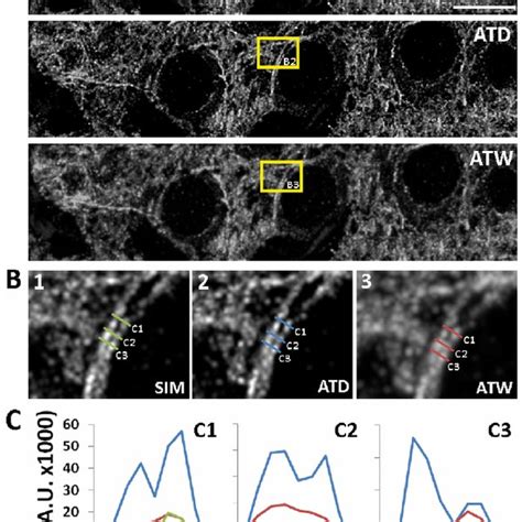 Two Dimensional Richardson Lucy Deconvolution Of Array Tomographic Download Scientific Diagram