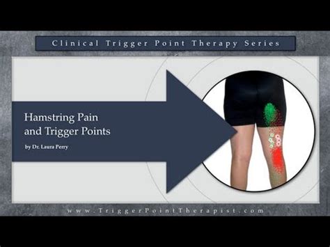 Hamstrings Trigger Points