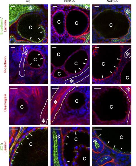 Figure 1 From Pkd1 And Nek8 Mutations Affect Cell Cell Adhesion And