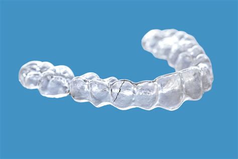 Cracked Invisalign Retainer What It Means And What To Do