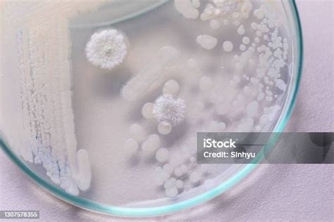피치아는 교육을 위한 현미경의 밑에 가족 사카로미세타아에 있는 효모의 속입니다 발효에 대한 스톡 사진 및 기타 이미지 발효 현미경 효모 Istock