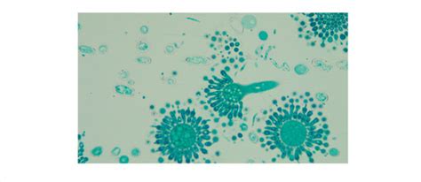 Microbiology Lab Exam 1 Flashcards Quizlet