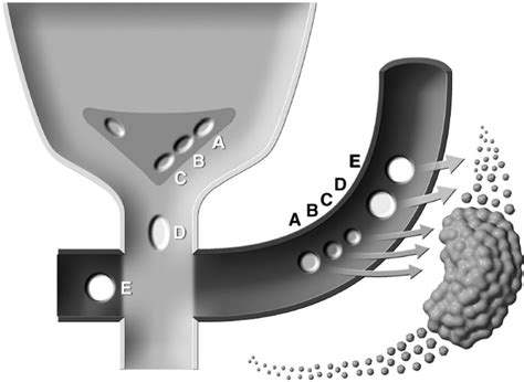 Ureteral Ectopia Ivis