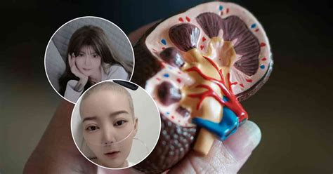 28歲電競網紅腎癌病逝！生前勸粉絲戒4個生活壞習慣、別吃一類食物！醫生：無故出現一症狀要即求診！ 健康解「迷」 醫學通識 健康好人生 Etnet 經濟通 香港新聞財經資訊和生活平台