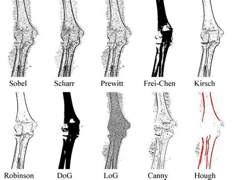 Sample Output Images From All Ten Edge Detection Methods Obtained From Download Scientific