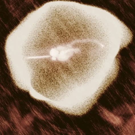 Echo Graph Ana Maria Caballero