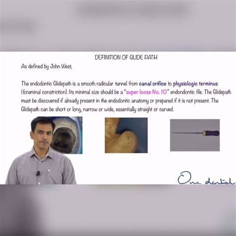 What Is A Glide Path One Dental Is The Biggest Online Platform For