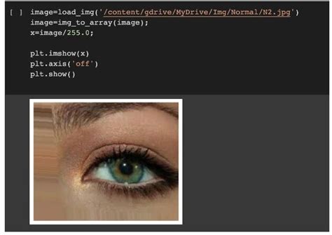 Implementing VGG Using Pre Trained Model Shiksha Online
