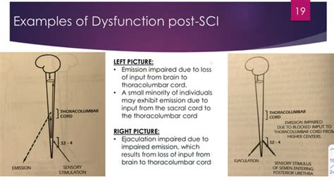 Bowel Bladder Sexual Function Flashcards Quizlet