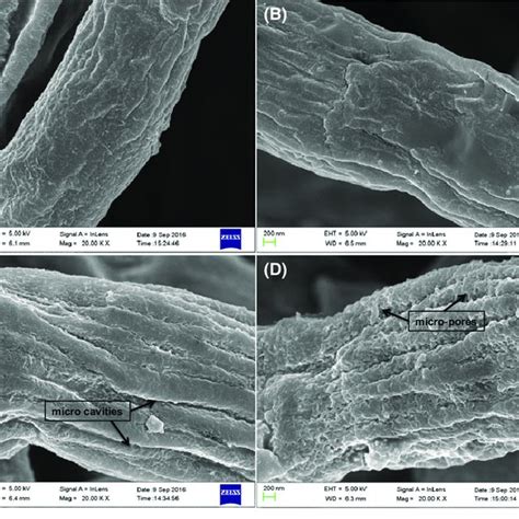 Sem Image Of Mycelium Morphology At Different Concentrations Of Triton