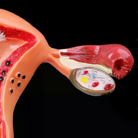 Medical Props Model Free Postage Pathological Uterus Ovary Anatomical