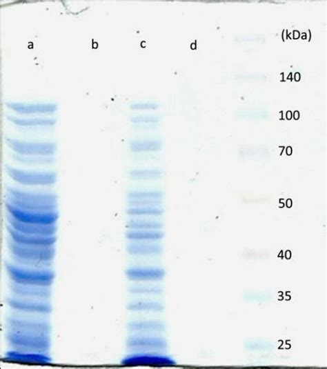 Sds Page Prsetemgfp Hpv52 L1 The Size Of Protein Of Interest Is 48