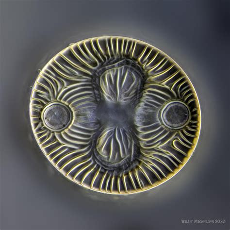 Diatoms In Circular Oblique Light Update 0605