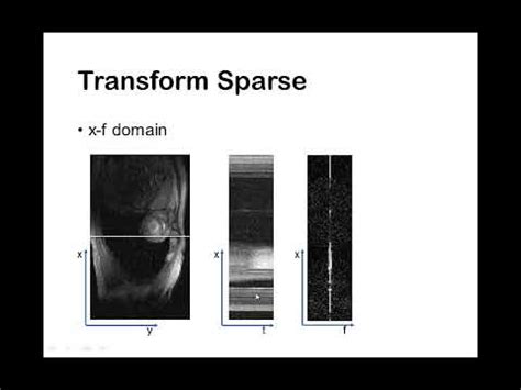 MRI Recon Course Compressed Sensing YouTube