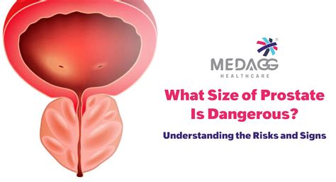 Understanding Blocked Fallopian Tubes Symptoms Key Insights For Women