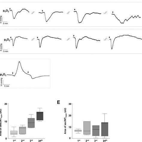Cortical Spreading Depolarization Csds Within Clusters And Download Scientific Diagram