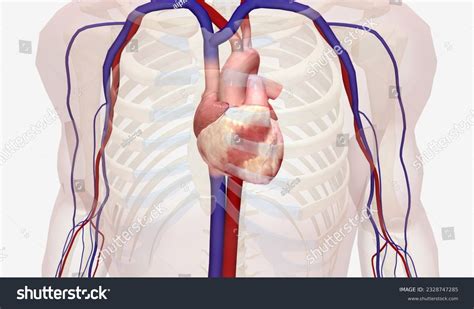 Implantable Loop Recorder Images Stock Photos Vectors Shutterstock