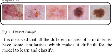 Figure 1 From Multiclass Skin Disease Classification Using Generative