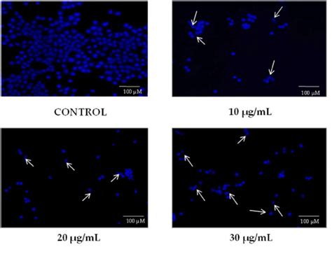 Dapi Staining In Mcf 7 Cell Lines Variation In Nuclear Morphology