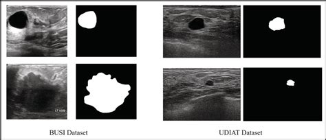 Sample Dataset Images From Busi And Udiat Datasets With Respective Download Scientific Diagram