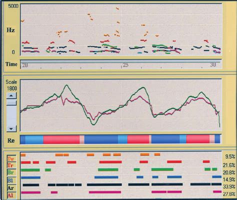 the spectral display of wheezes detected with the automatic wheeze
