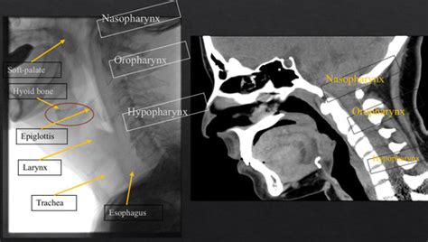 Upper And Lower Gi Tract Imaging Flashcards Quizlet