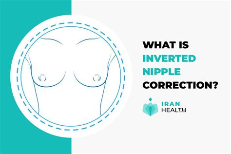 Inverted Nipple Correction In Iran Best Cost And Surgeon In Iran