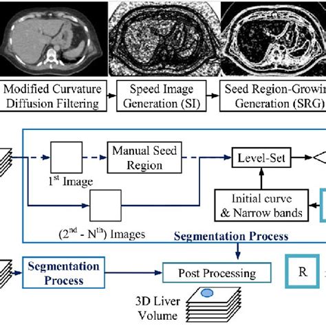 A Diagram Of Liver Segmentation Based On The Lssi Technique Download