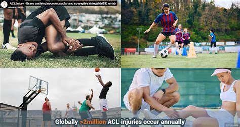 Acl Injury News Orthoservice Roten En