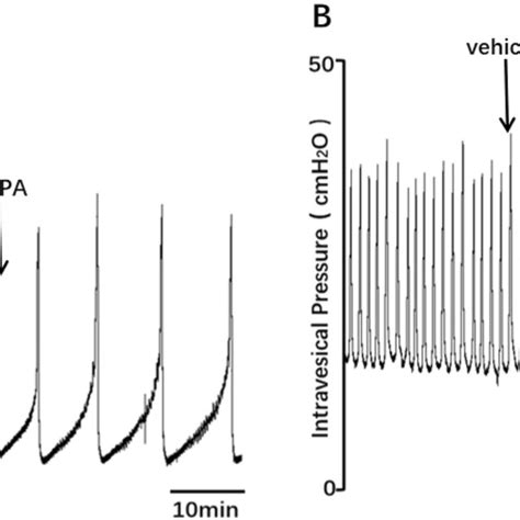 Representative Cystometrogram Of Control A N 8 And Cystitis B Download Scientific