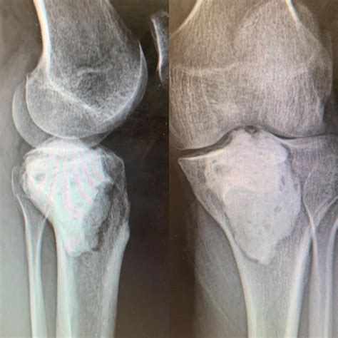 Weekly Reminder R Radiology