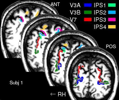 Intraparietal Sulcus Location