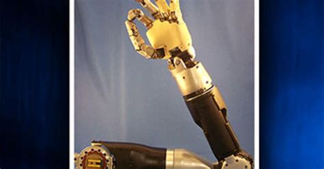 Researchers Seek To Fuse Nerves Robot Limbs Cbs News
