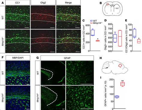 Mt1 Mmp Deficient Mice Display Corpus Callosum Agenesis And
