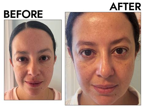 The 15 Best Niacinamide Products Tested