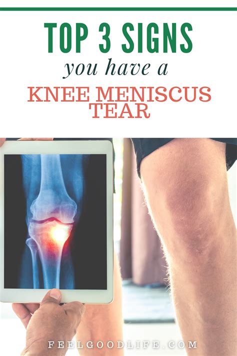 Top 3 Signs You Have A Knee Meniscus Tear And How To Fix It Artofit