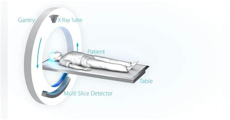 The Laser Institute On Linkedin Photon Counting Detectors Are Poised To Revolutionize Computed