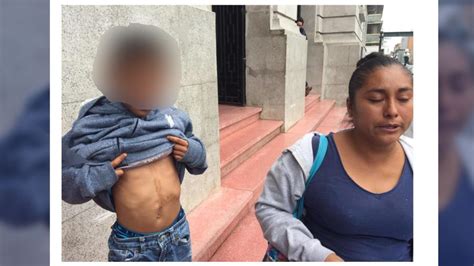 Notigape Madre Pide Ayuda Para Tratamiento De Su Hijo