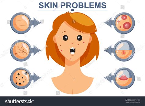 Skin Problems Vector Infographics Cartoon Illustration 库存矢量图（免版税