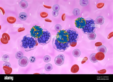 Car T Cell Therapy In Diffuse Large B Cell Lymphoma Dlbcl Isometric