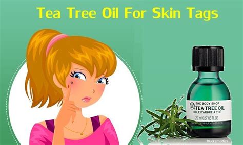 15 Uses Of Tea Tree Oil For Skin Tags Warts And Moles