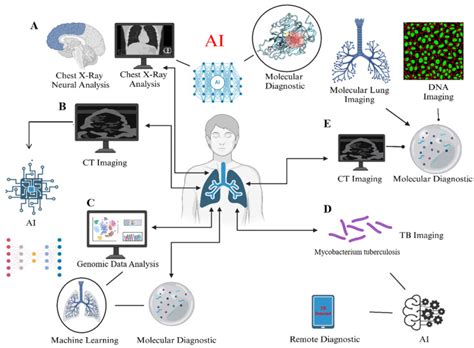 Integration Of Ai And Ml In Tuberculosis Tb Management From