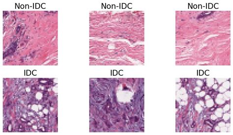 Comparative Analysis Of Transfer Learning Models For Breast Cancer