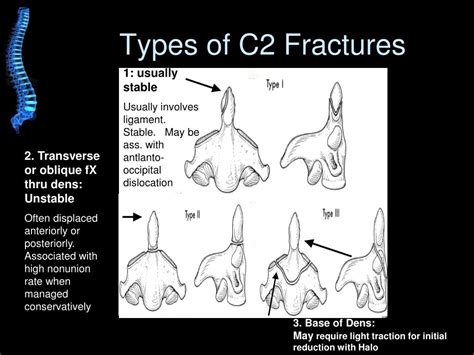 Ppt Against All Odds Maximizing Outcomes In Sci Powerpoint