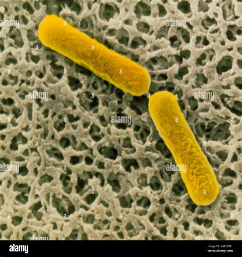 Scanning Electron Micrograph Of Two Individual Rod Like Gram Positive Bacteria Of The Species
